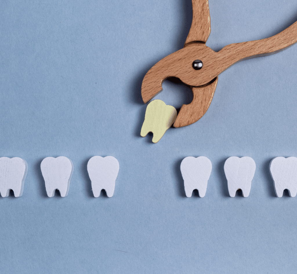 Tooth Extraction Boulder, CO | PeakView Dentistry | What to Expect ...